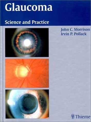 Glaucoma: Science and Practice by John C. Morrison (2002-12-15): Books ...