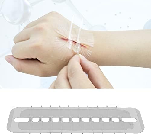 Amazon.com: Zip Stitch Wound Closure Device, 2 Pcs Zipstitch Laceration ...