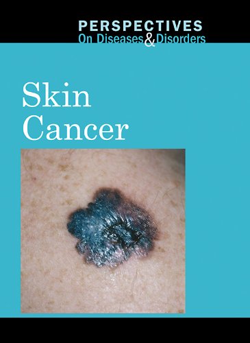 Skin Cancer (Perspectives on Diseases and Disorders): Fredericks ...