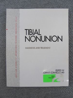 Amazon.com: Tibial Nonunion: Diagnosis and Treatment: 9780892030484 ...