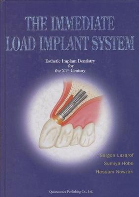 Amazon | Immediate Load Implant System: Esthetic Implant Dentistry for ...