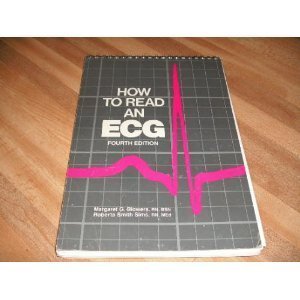 How to Read an Ecg: Blowers, Margaret G.: 9780874894974: Amazon.com: Books