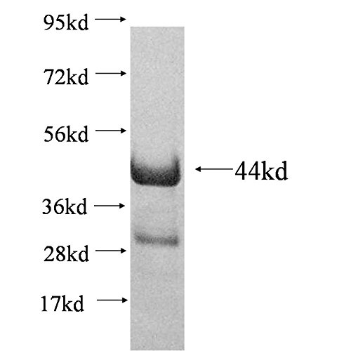 Amazon.com: Human AGL Fusion Protein : Industrial & Scientific