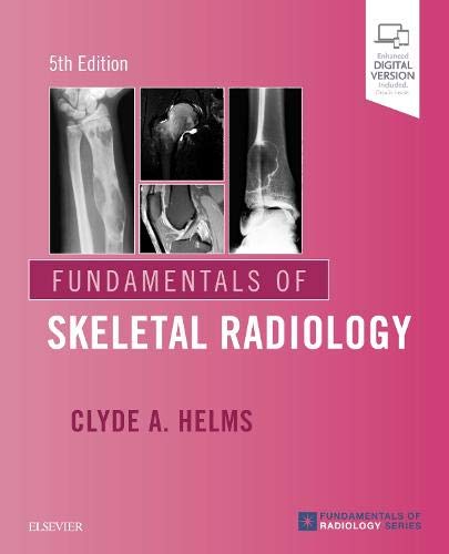 Fundamentals of Skeletal Radiology by Helms MD, Clyde A.