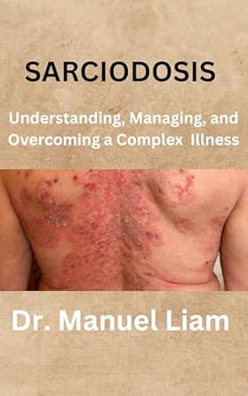 Sarcoidosis: Understanding, Managing, and Overcoming a Complex Illness eBook : Liam, Manuel ...