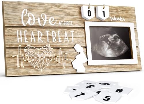 Amazon.com : Sonogram Picture Frame,Baby Ultrasound Picture Frames With ...