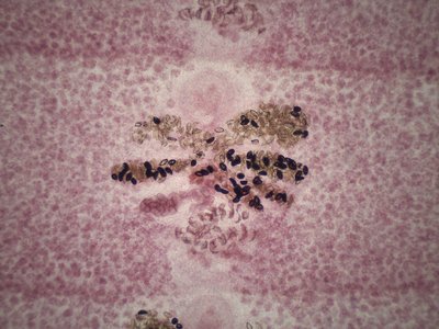 Tapeworm Proglottids Slide