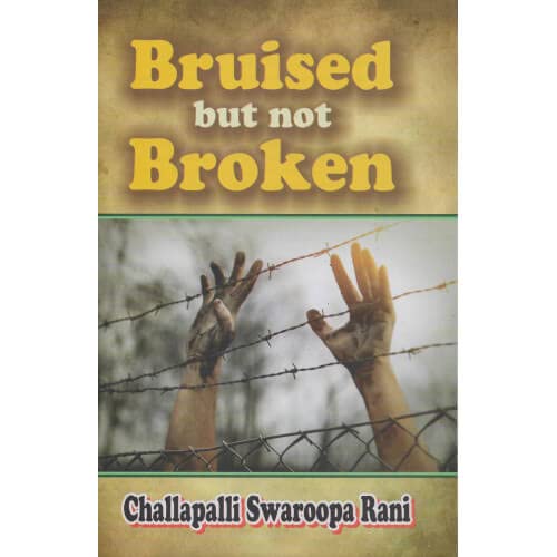 Buy Bruised But Not Broken Book Online at Low Prices in India | Bruised ...