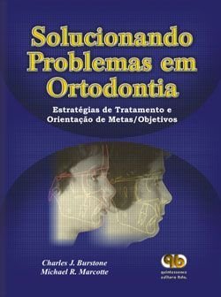 Amazon.com: Solucionando Problemas Em Ortodontia: 9788587425508 ...