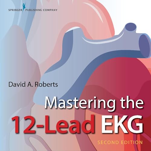 Amazon.com: Mastering the 12 Lead EKG : Mastering the 12 Lead EKG ...