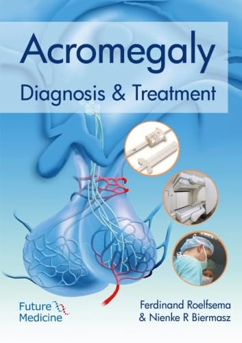 Acromegaly: Diagnosis and Treatment | Amazon.com.br
