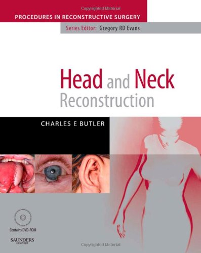 Head and Neck Reconstructionwith DVD: A Volume in the Procedures in ...