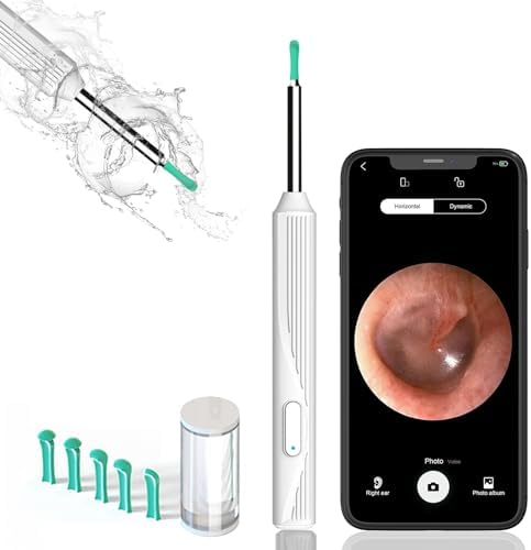 Amazon.com: Ear Cleaner with Camera, Earwax Remover kit, 1080P FHD ...