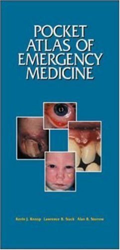 Pocket Atlas of Emergency Medicine: 9780071358071: Medicine & Health ...