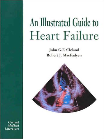 An Illustrated Guide to Heart Failure: Cleland, J. G., Macfadyen ...
