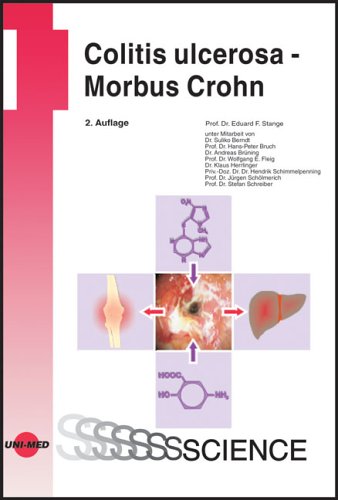 Amazon.com: Colitis ulcerosa - Morbus Crohn: 9783895998287: Hofstede ...