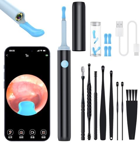 Amazon.com: MAGIC JOHN Ear Wax Removal Tool, Ear Cleaner with Camera ...