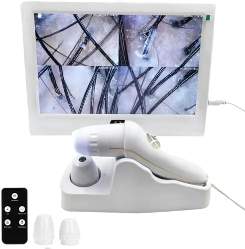 Amazon.com : Skin Diagnosis Hair Analyzer, 12inch Skin Scalp Detector ...