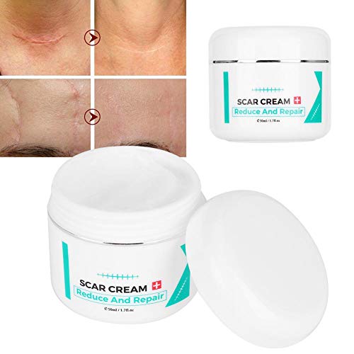 Narbencreme kaufen • Bestseller im Überblick 2022 | testigel.de