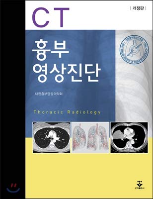 Chest CT (Korean Edition): Korean Society for Thoracic Radiology ...