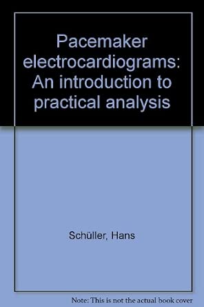 Pacemaker electrocardiograms: An introduction to practical analysis ...