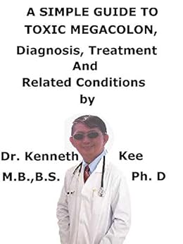 A Simple Guide To Toxic Megacolon, Diagnosis, Treatment And Related ...