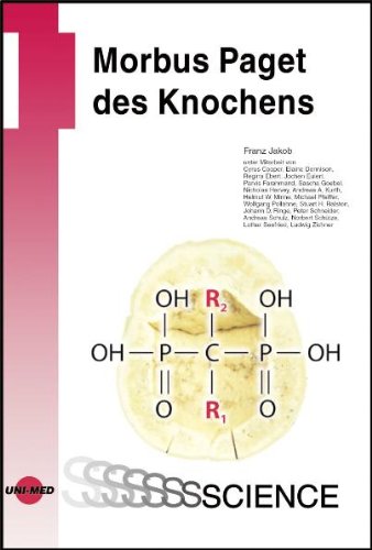 Amazon.com: Morbus Paget des Knochens: 9783895998904: Franz Jakob: Books