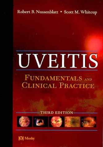 Uveitis: Fundamentals and Clinical Practice: 9780323022378: Medicine ...
