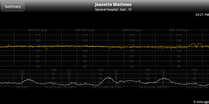 AirStrip OB:Amazon.com:Appstore for Android