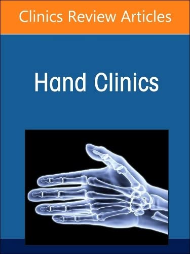 Managing Difficult Problems in Hand Surgery: Challenges, Complications ...