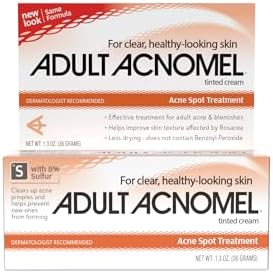 Amazon.com: Adult Acnomel Acne Medication Cream, 1.3 Ounces ...