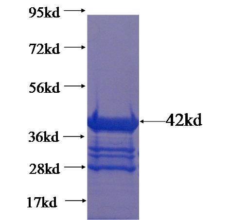 Amazon.com: Human OTUD6A Fusion Protein : Industrial & Scientific
