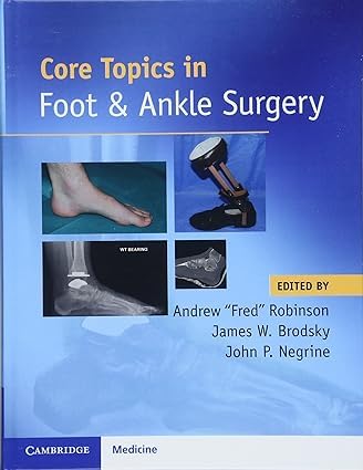 Buy Core Topics in Foot and Ankle Surgery Book Online at Low Prices in ...