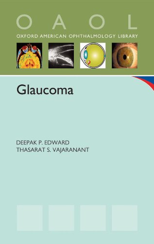 Amazon.com: Glaucoma (Oxford American Ophthamology Library) eBook ...