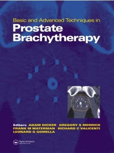 Basic and Advanced Techniques in Prostate Brachytherapy: 9781841842981 ...