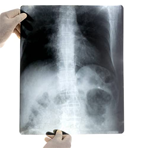 VMS HI-Speed conventional X-Ray Medical Film Blue Base Sensitive 8 inch ...