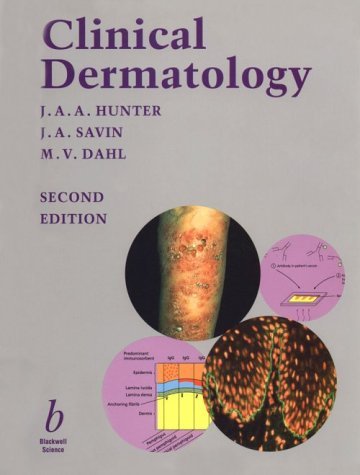 Clinical Dermatology: 9780632037148: Medicine & Health Science Books ...
