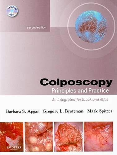 Colposcopy: Principles and Practice, an Integrated Textbook and Atlas ...