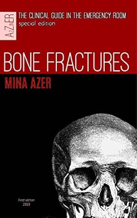 Bone Fractures: special edition of the clinical guide in the Emergency ...
