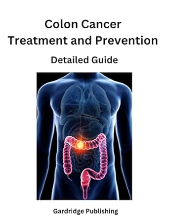 Colon Cancer Treatment and Prevention - Detailed Guide eBook ...