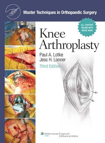 Master Techniques in Orthopaedic Surgery: Knee Arthroplasty: Lotke MD ...