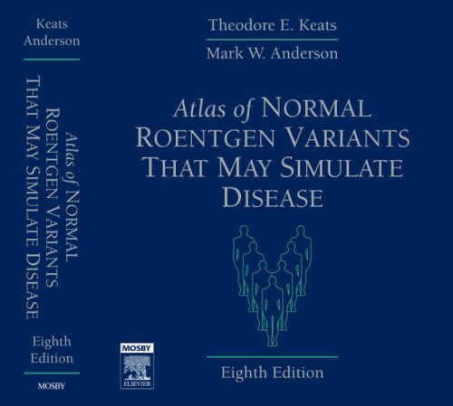 Atlas of Normal Roentgen Variants That May Simulate Disease ...