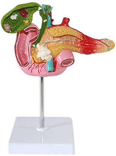 Buy AIVYNA Educational Science Model Pancreas Duodenal Gallbladder ...