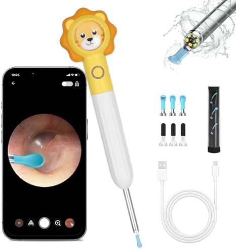 Amazon.com: Ear Wax Removal Tool, Ear Wax Removal with Ear Camera and ...