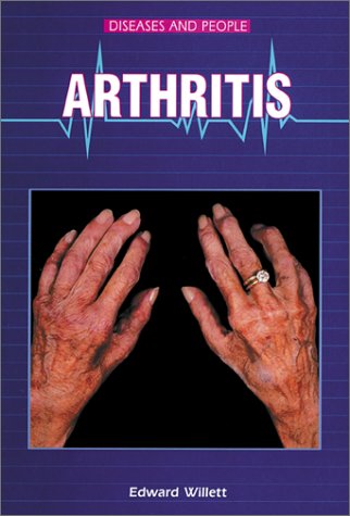 Amazon.com: Arthritis (Diseases and People): 9780766013148: Willett ...
