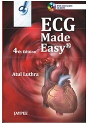 ECG Made Easy: Luthra, Atul: 9789350255919: Amazon.com: Books