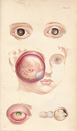 A Practical Work on the Diseases of the Eye, and Their Treatment ...