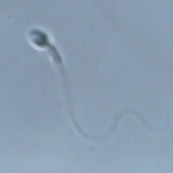Sperm Under Microscope