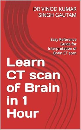 Amazon.com: Learn CT scan of Brain in 1 Hour: Easy Reference Guide for ...