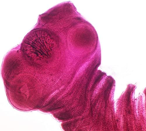 Amazon.com: 10-Set Prepared Parasitology Microscope Slides for Medical ...